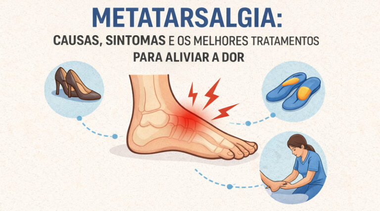 Metatarsalgia: Causas, Sintomas e Tratamentos para Aliviar a Dor
